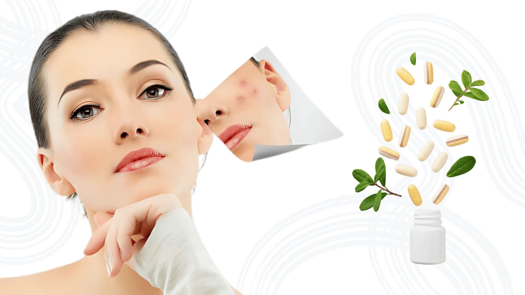 Best Supplements for Hormonal Acne: Try Lactofyn™ with Probiotics